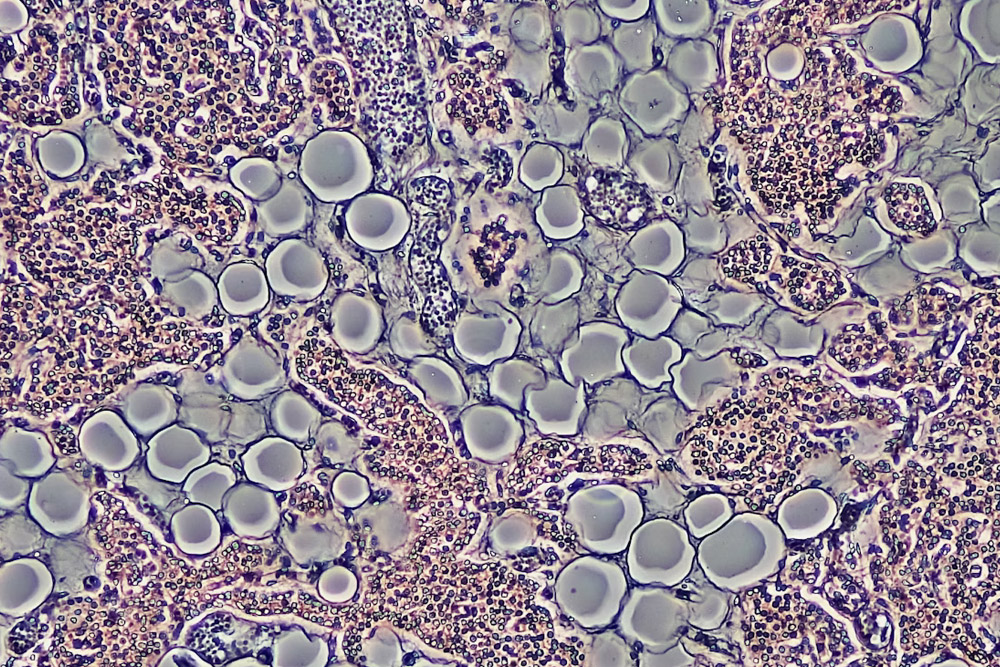 What Is Mast Cell Activation Syndrome? Signs, Symptoms, and Root Causes ...